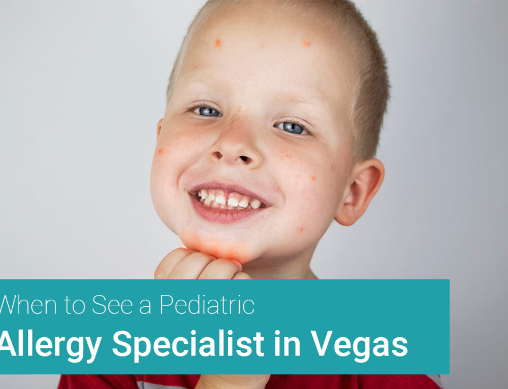 How to Interpret The Different Levels of Allergic Reactions - Tottori ...