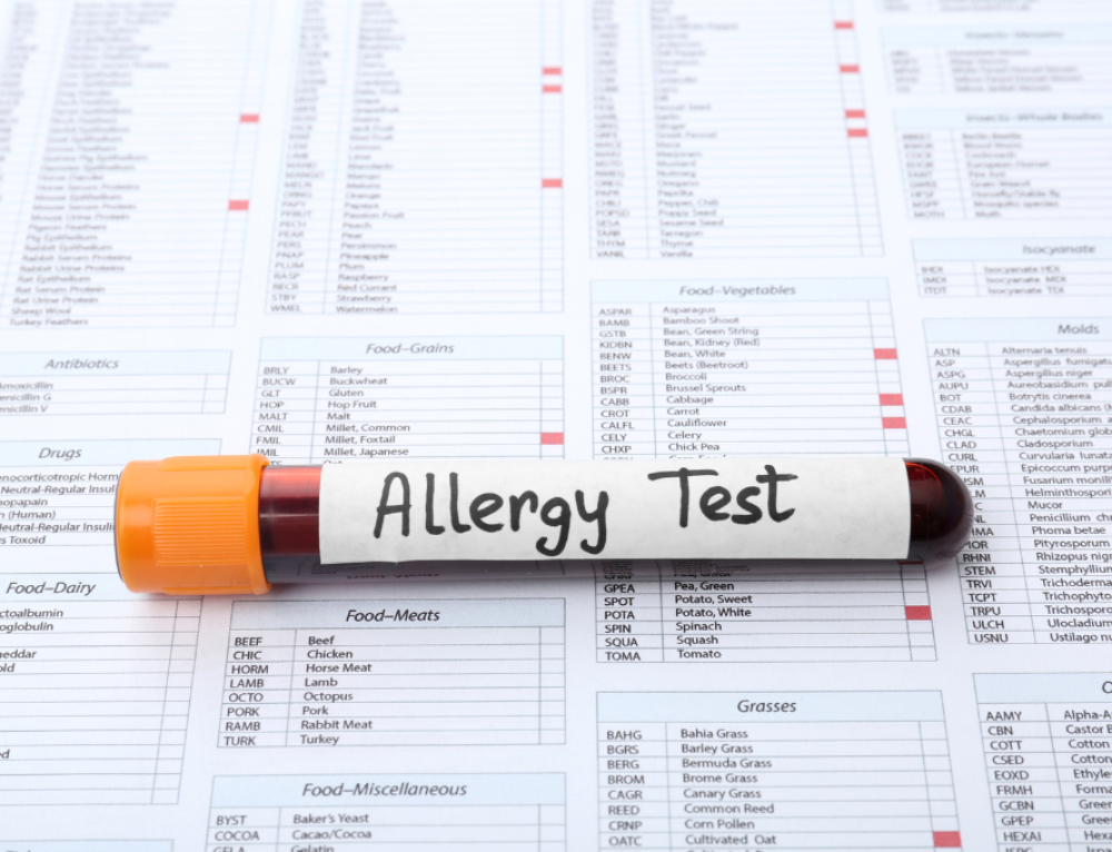 How to Interpret The Different Levels of Allergic Reactions - Tottori ...